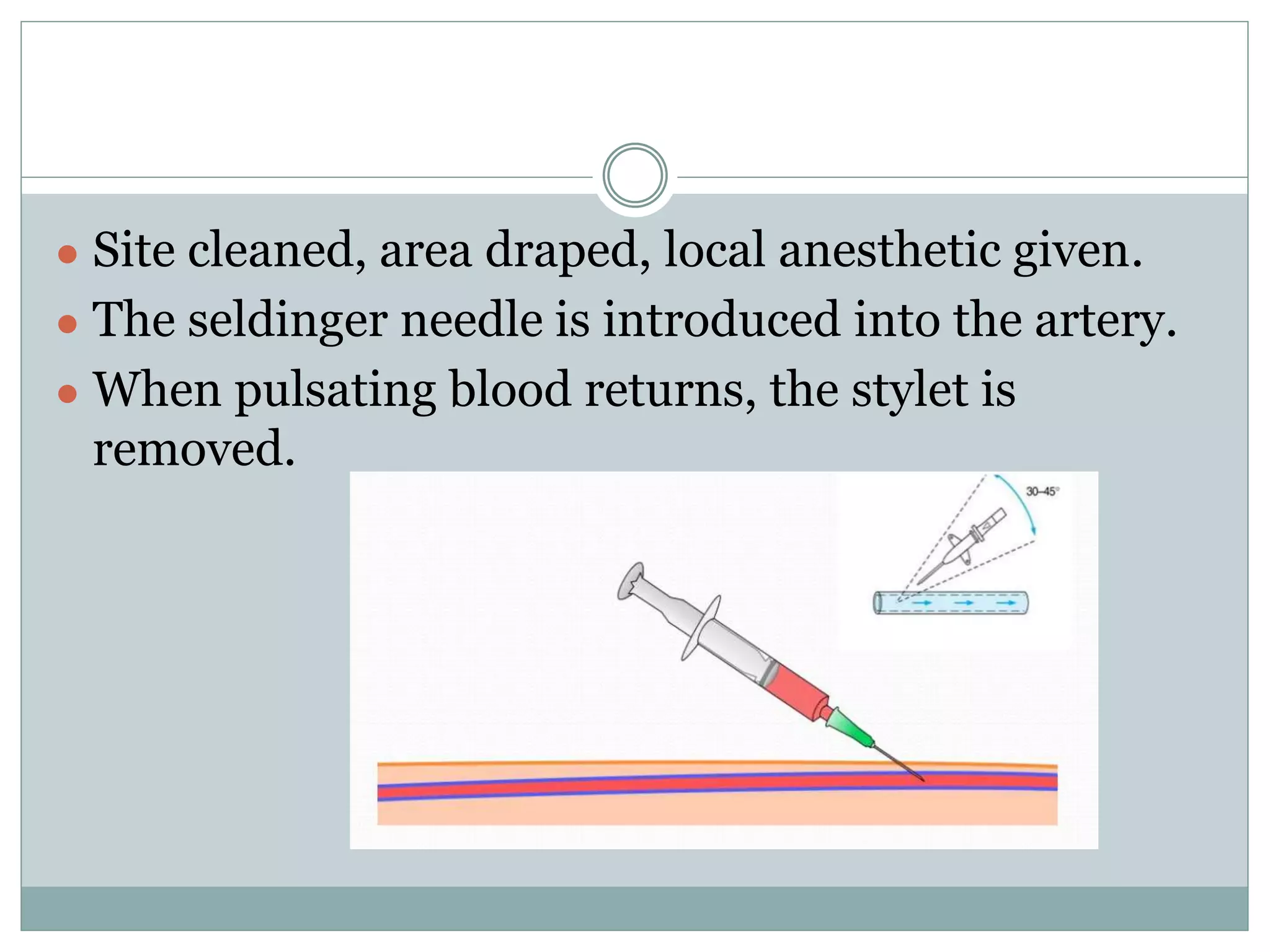 Cerebral angiography procedure | PPTX
