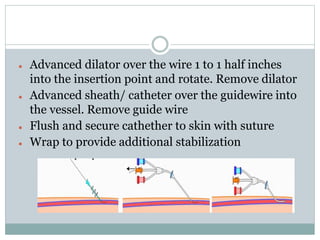 Cerebral angiography procedure | PPTX