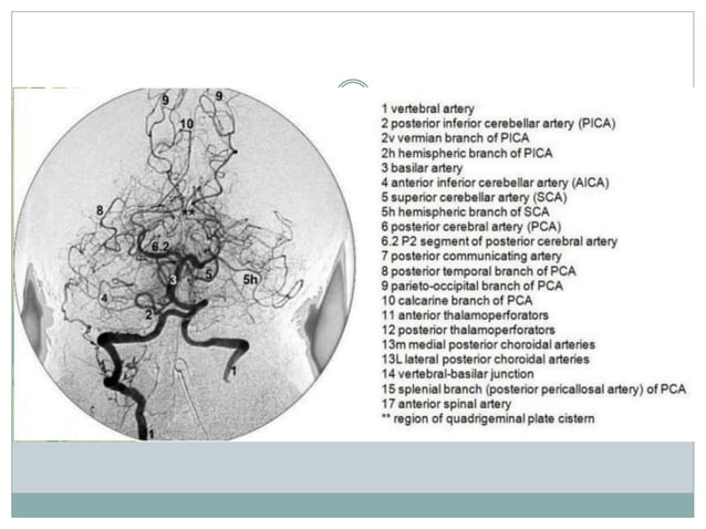 Cerebral angiography procedure | PPTX
