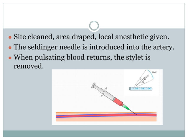 Cerebral angiography procedure | PPTX