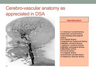 Cerebral angiography technique | PPTX