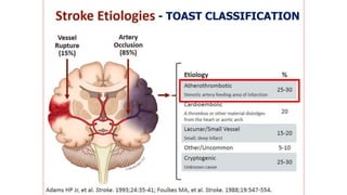 CEREBRAL ANGIOPLASTY IN ACUTE ISCHEMIC STROKE | PPTX