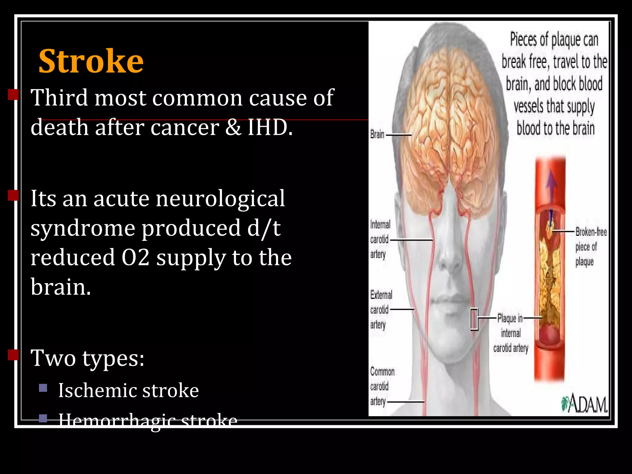 Cerebral circulation | PPT
