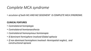 Cerebral circulation and brain stem syndromes | PPT