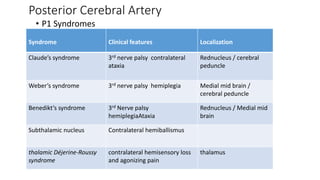Cerebral circulation and brain stem syndromes | PPT