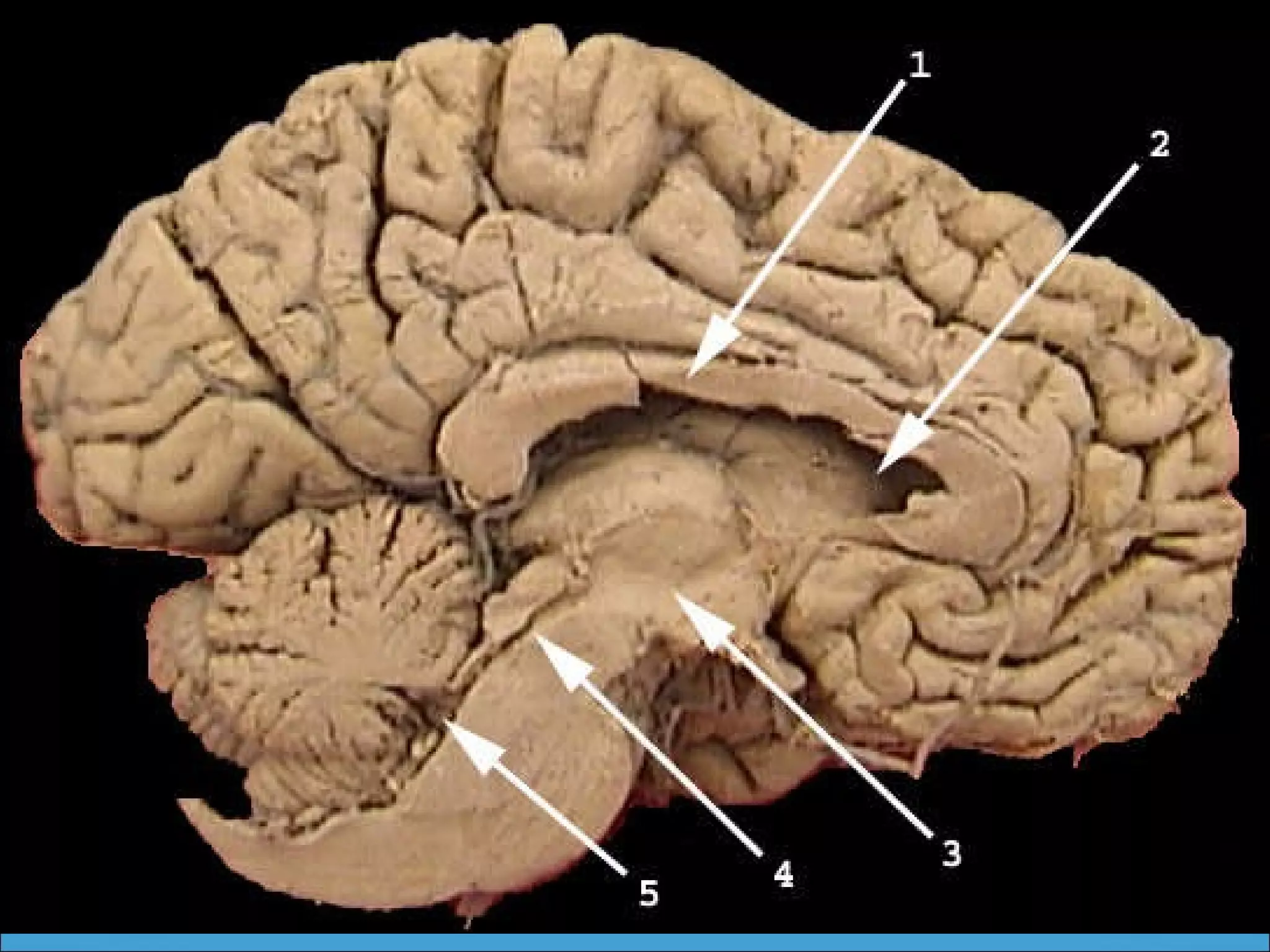 Cerebral circulation & csf formation | PPT