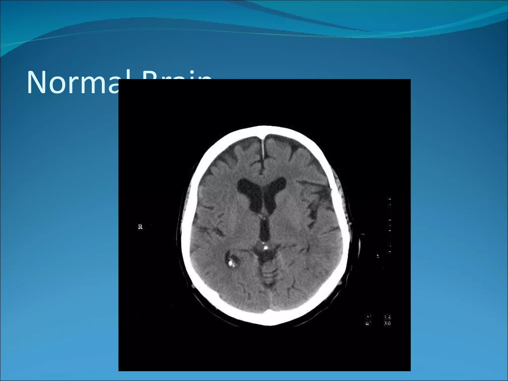 Cerebral circulation & csf formation | PPT