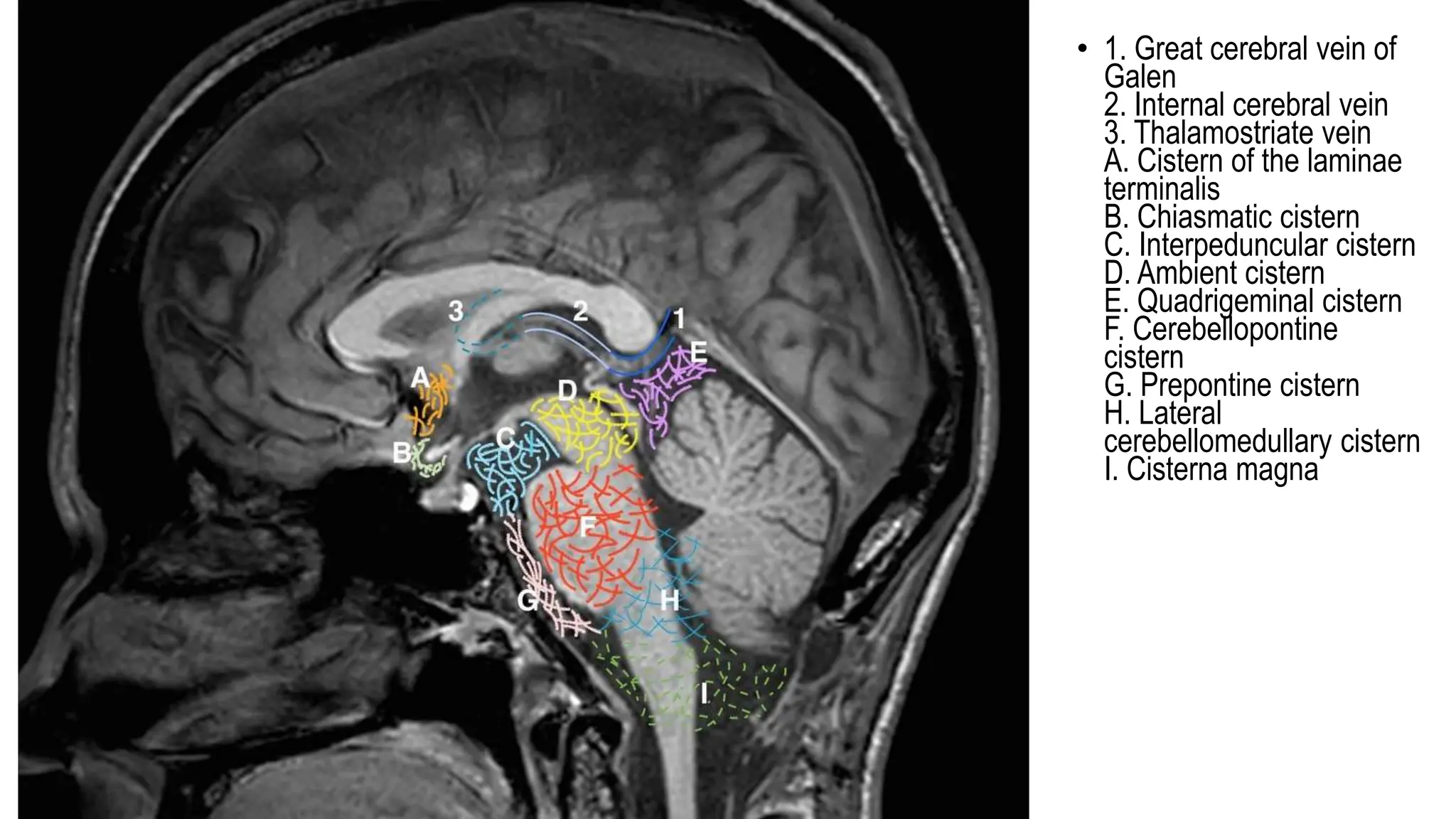 cerebral cisterns for radiology dnb .pptx