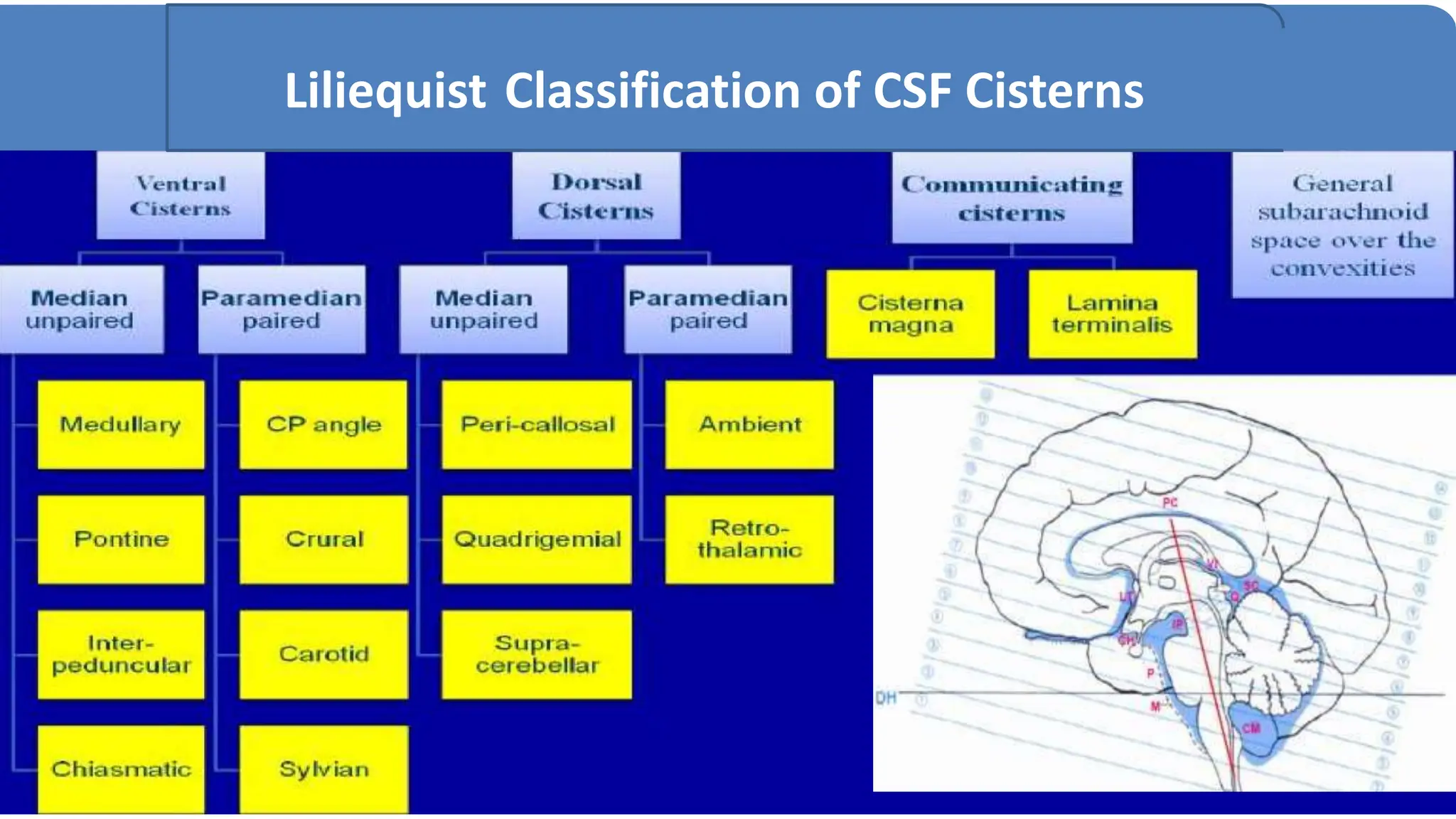 cerebral cisterns for radiology dnb .pptx