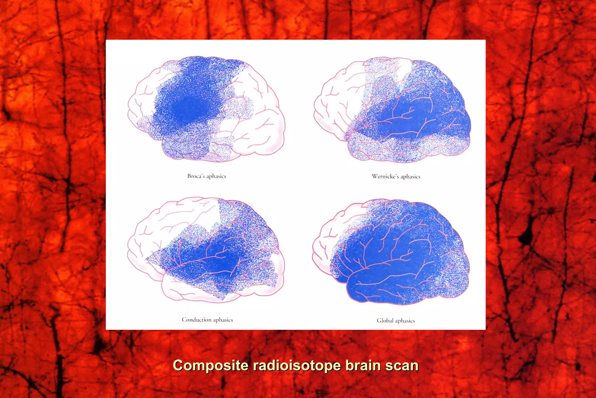 Cerebral cortex | PPS