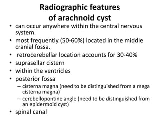 arachnoid cyst | PPTX
