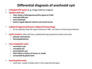 Differential Diagnosis Of Intraspinal Arachnoid Cysts – YGGD