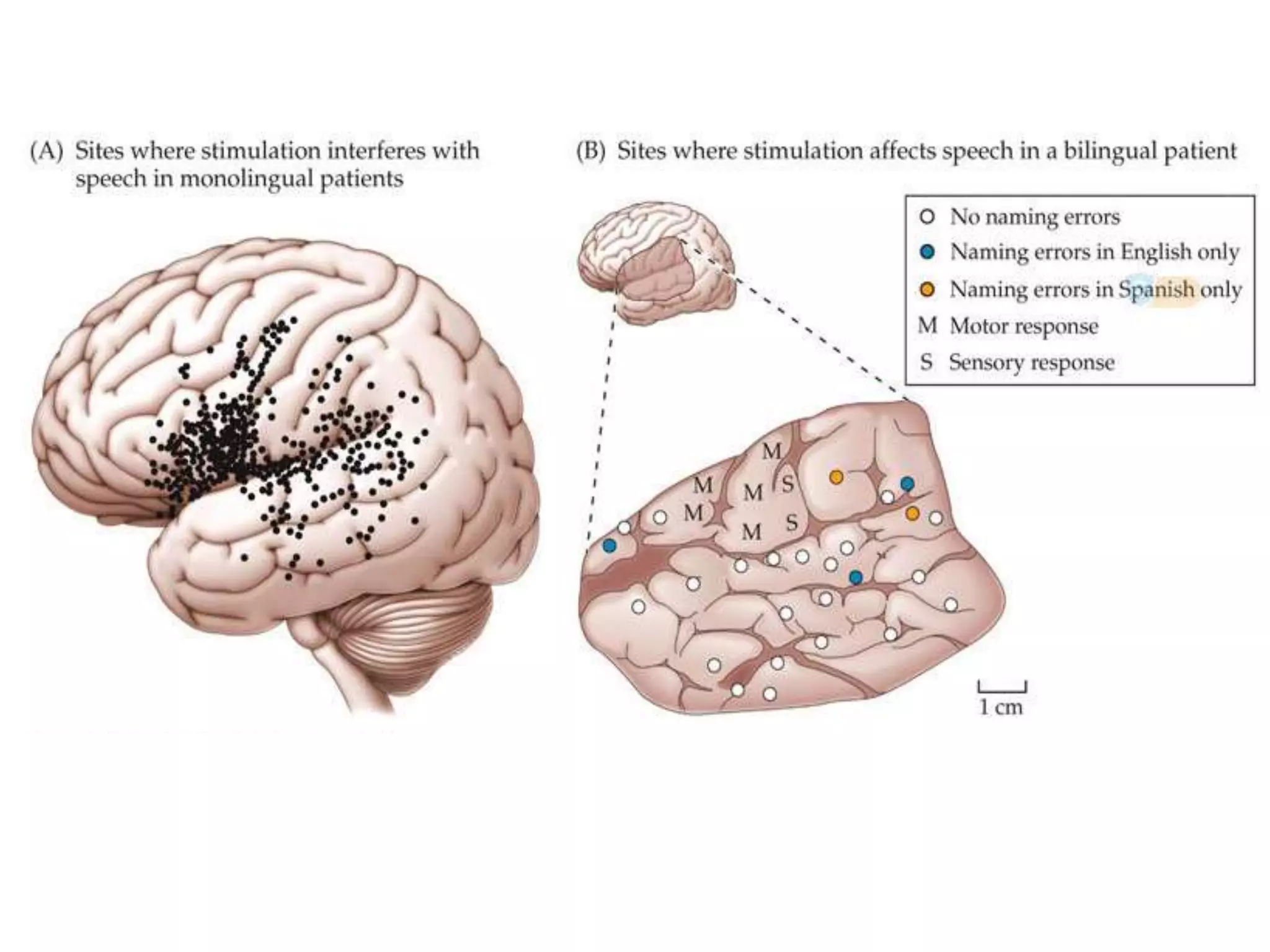 Cerebral dominance and language | PPTX
