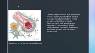 cerebral edema types management and description | PPTX