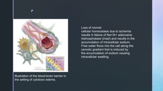 cerebral edema types management and description | PPTX