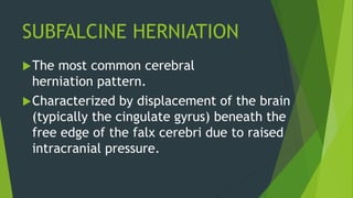 Cerebral herniation | PPTX