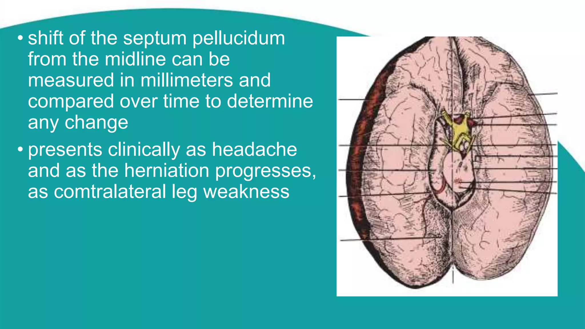 Cerebral herniation syndromes | PPTX