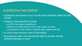 Cerebral herniation syndromes | PPTX