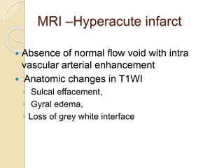 Cerebral Infarcts . pptx | PPTX