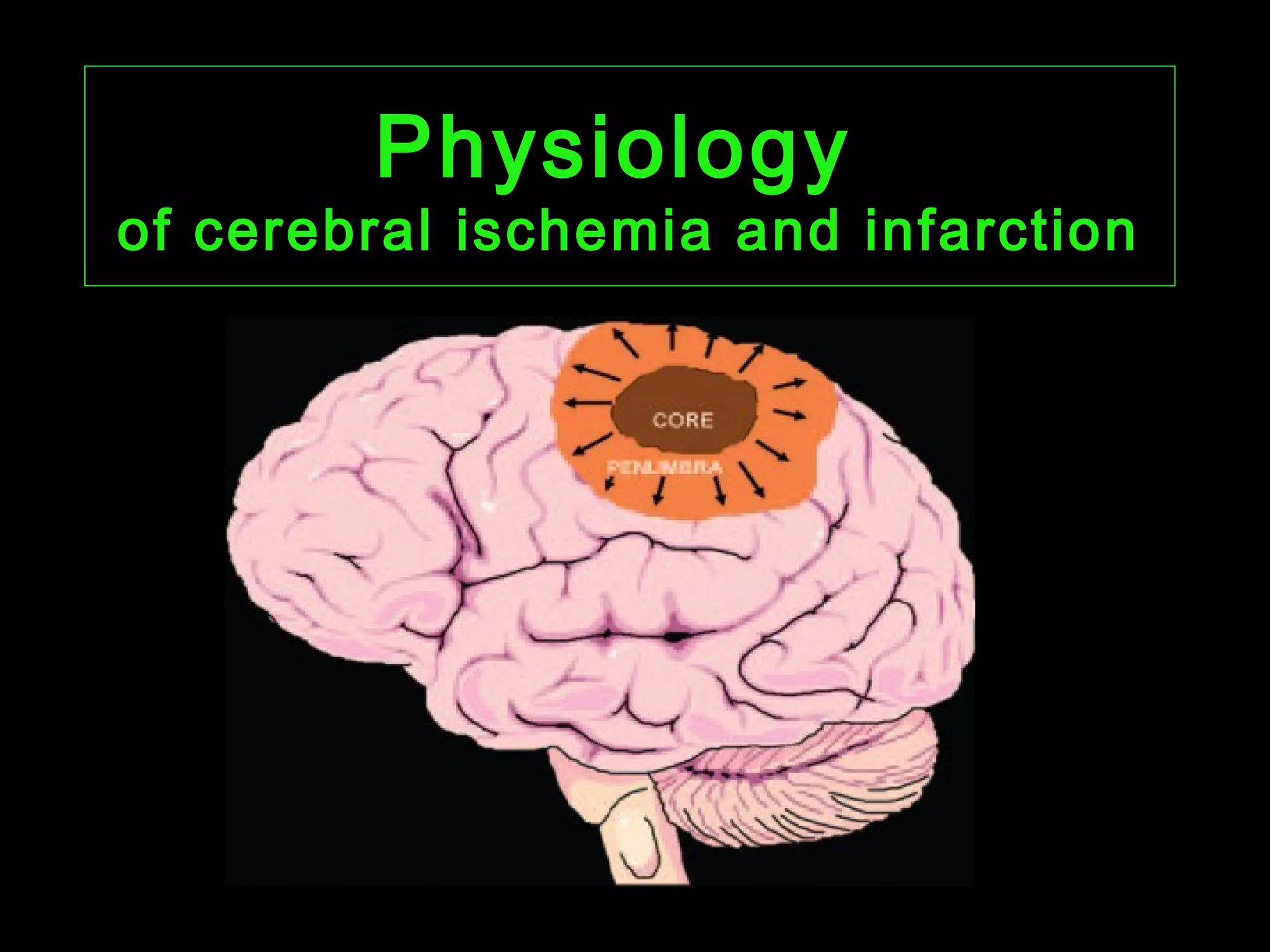 CT Imaging of Cerebral Ischemia and Infarction | PPT