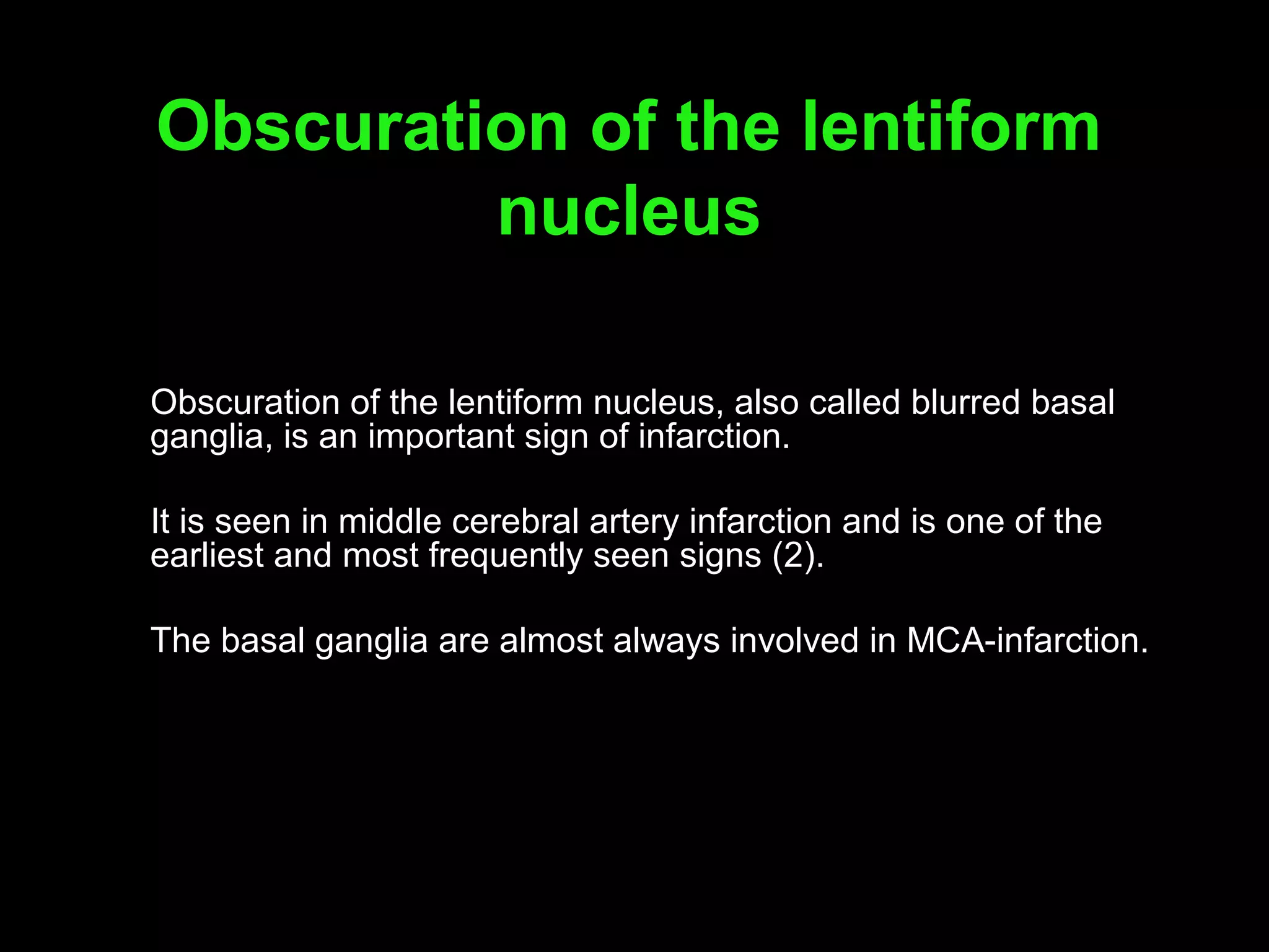 CT Imaging of Cerebral Ischemia and Infarction | PPT