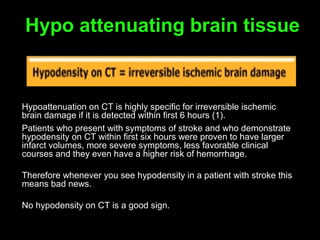 CT Imaging of Cerebral Ischemia and Infarction | PPT