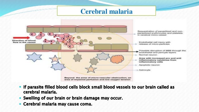 Cerebral malaria