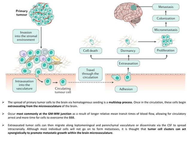 cerebral metastasis | PPT