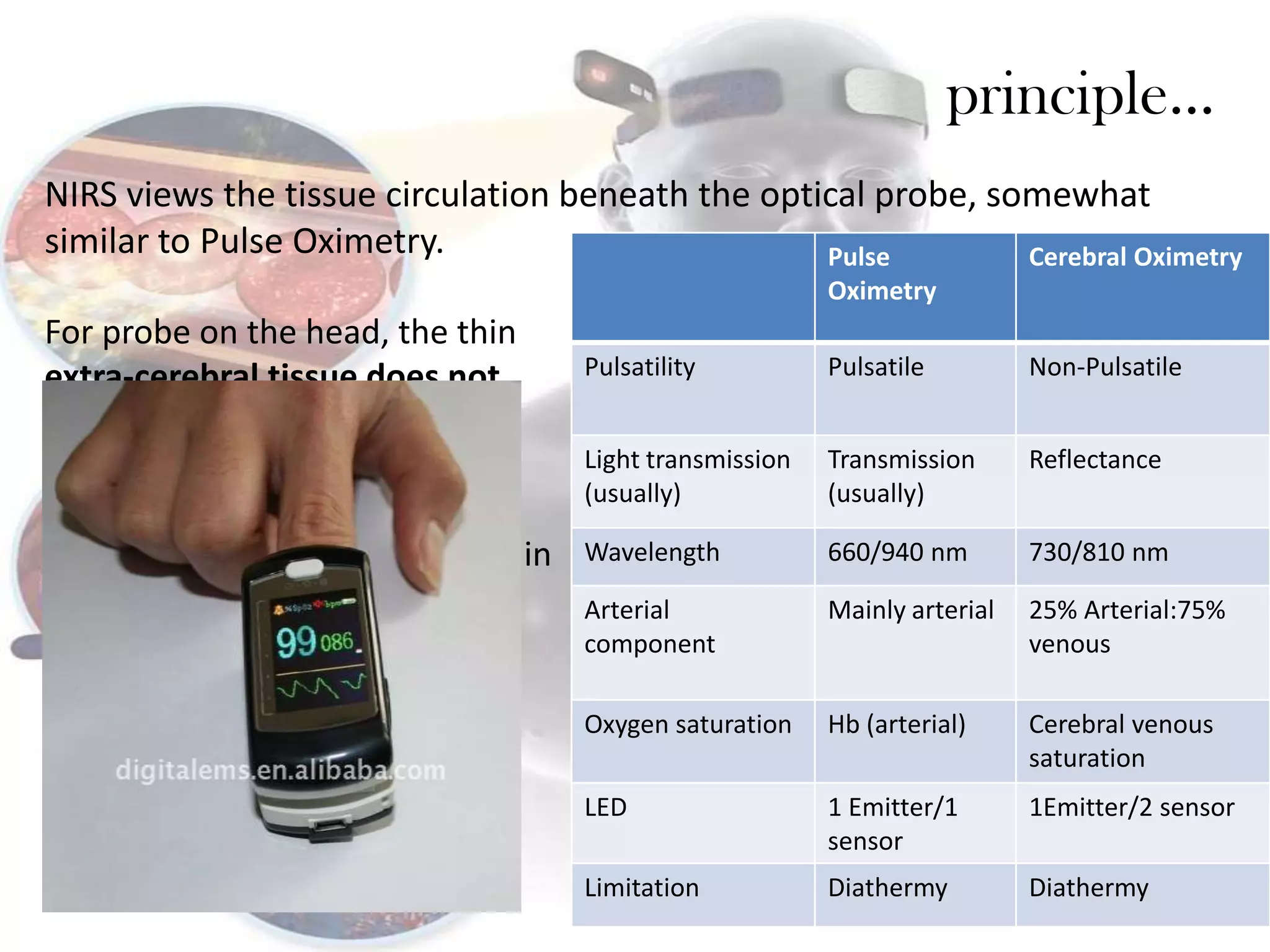 Cerebral oximetry | PPTX