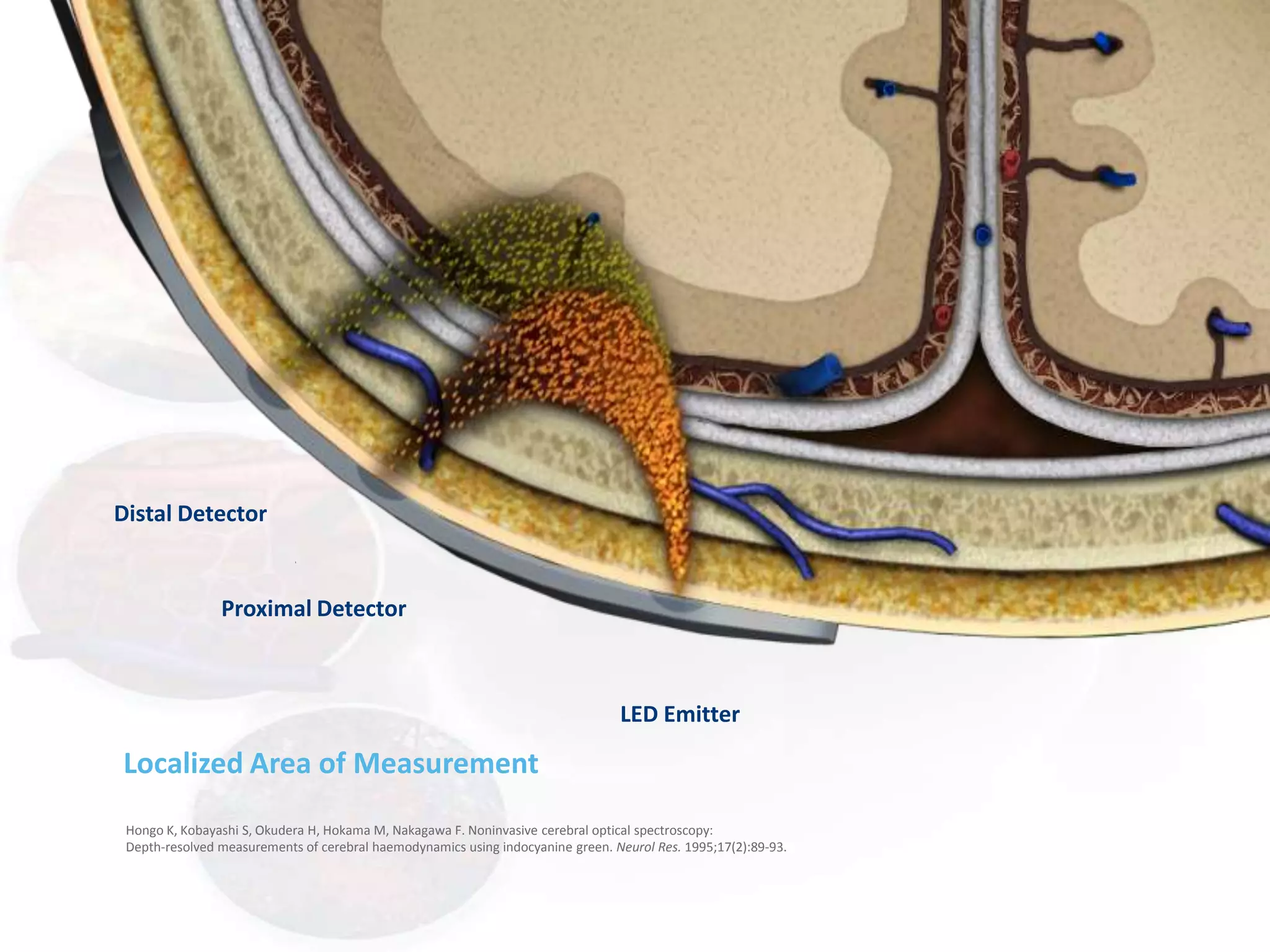 Cerebral oximetry | PPTX