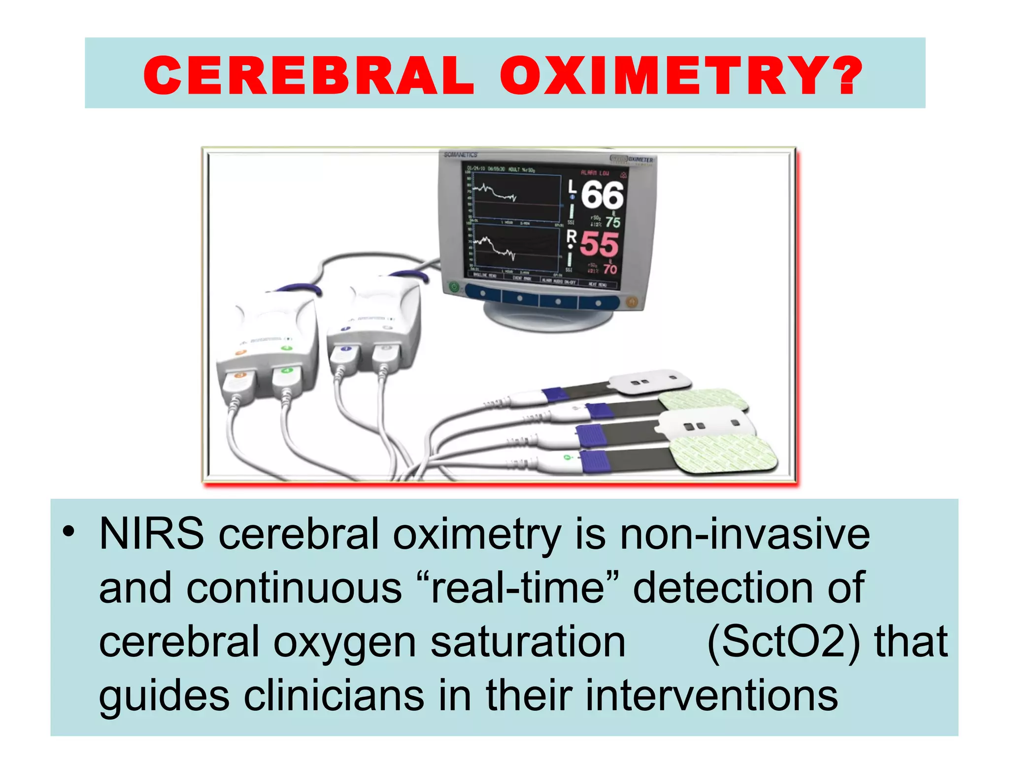Cerebral oximetry brain protection in cardiac surgery | PPT