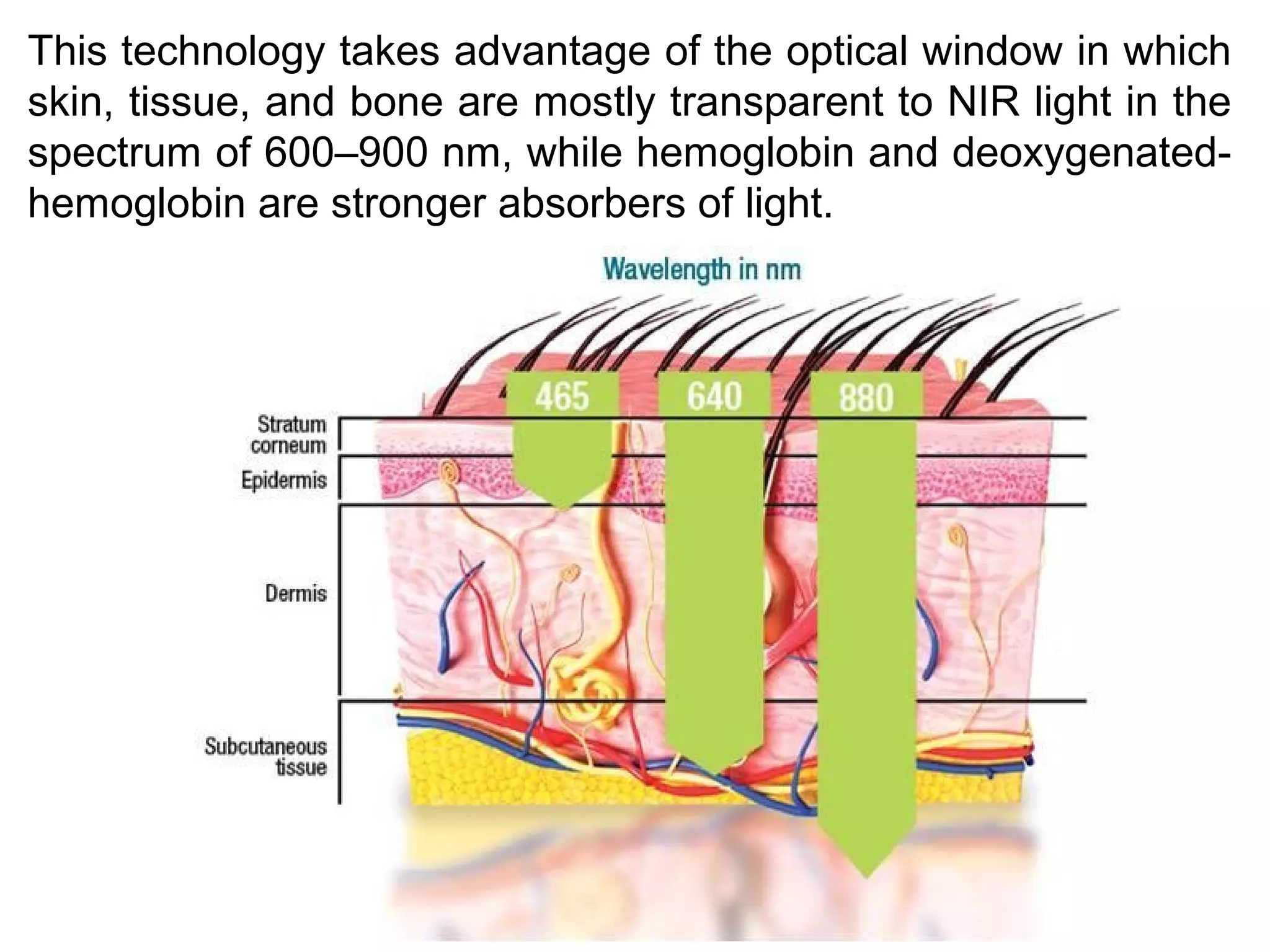 Cerebral oximetry brain protection in cardiac surgery | PPT