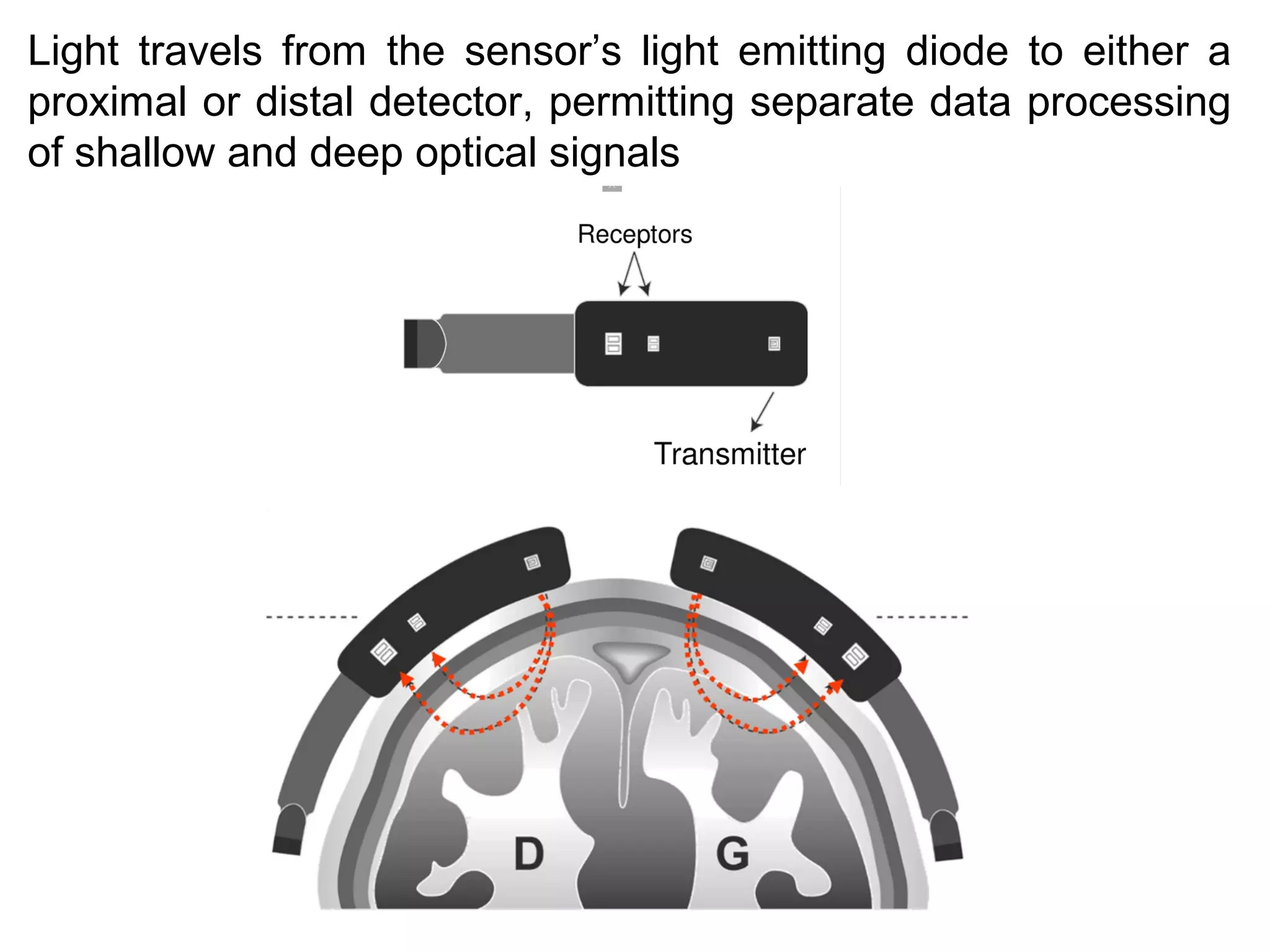 Cerebral oximetry brain protection in cardiac surgery | PPT