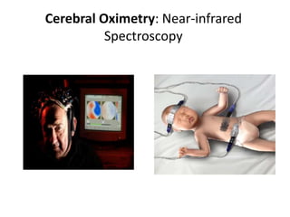 Cerebral oximetry in cerebral resuscitation | PPTX