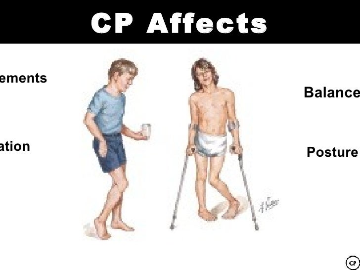 Cerebral Palsy