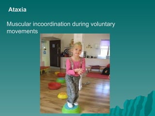 orthopedics.Cerebral palsy.(dr.baxtyar rasul) | PPT