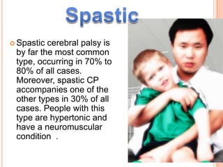 Cerebral palsy | PPT