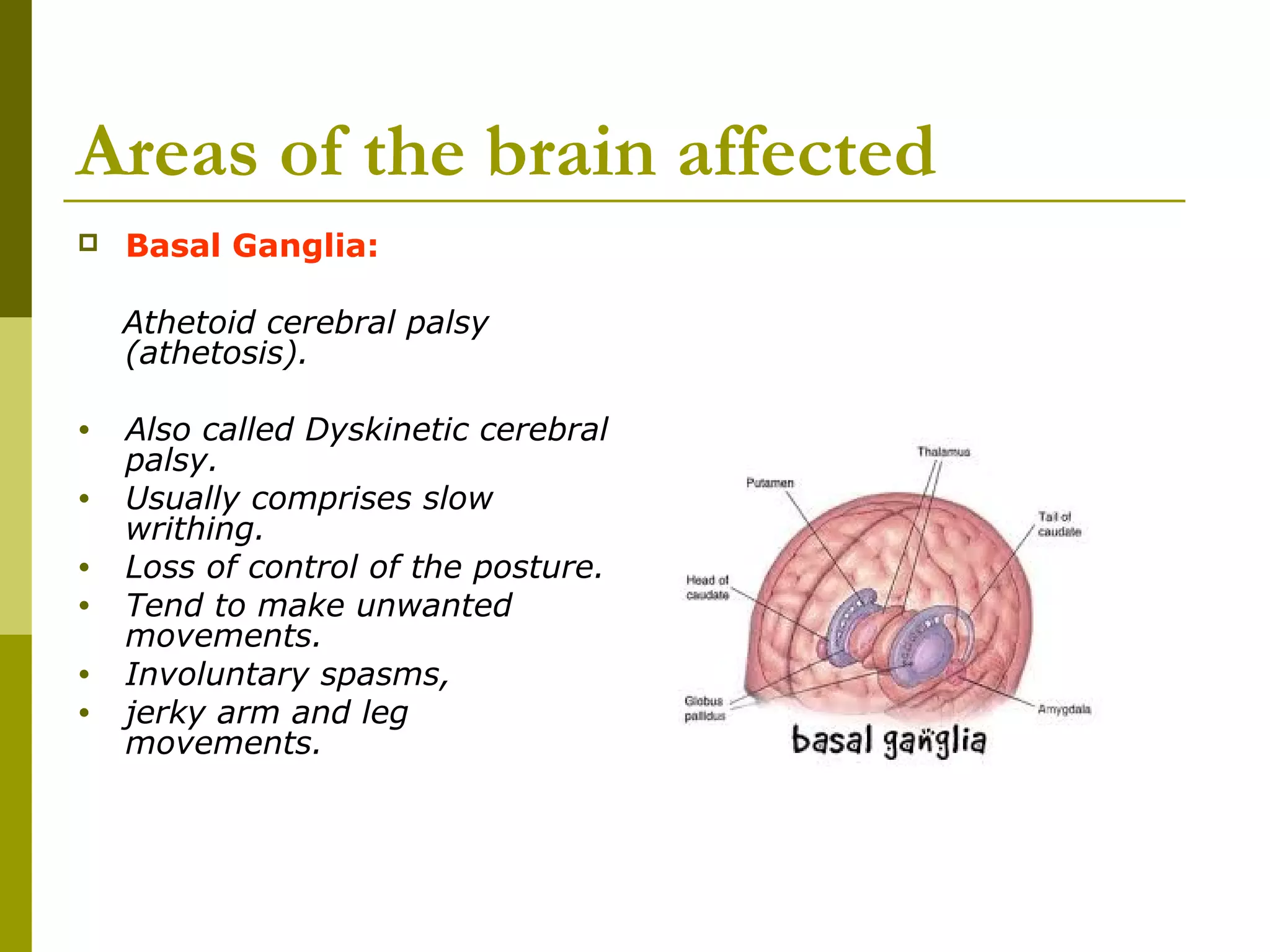 Cerebral palsy | PPT