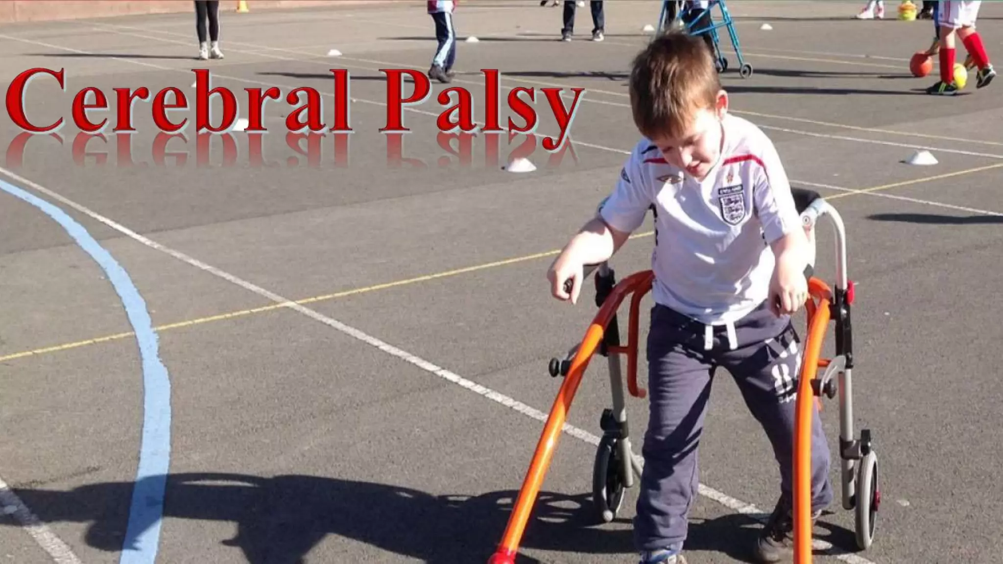 Cerebral palsy | PPTX