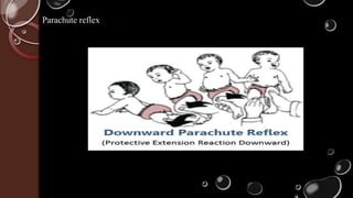 Cerebral palsy | PPTX