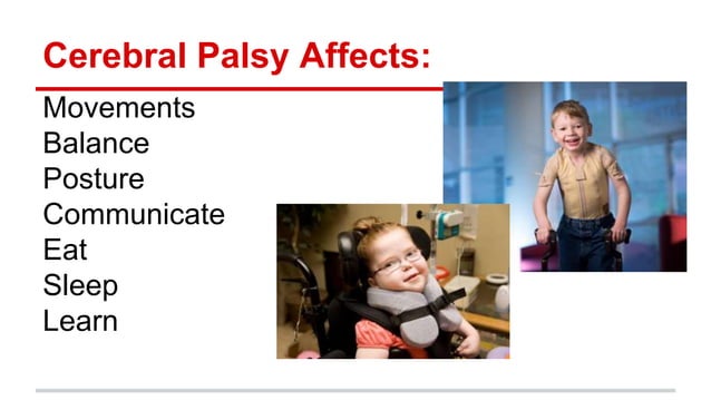 Cerebral Palsy | PPT