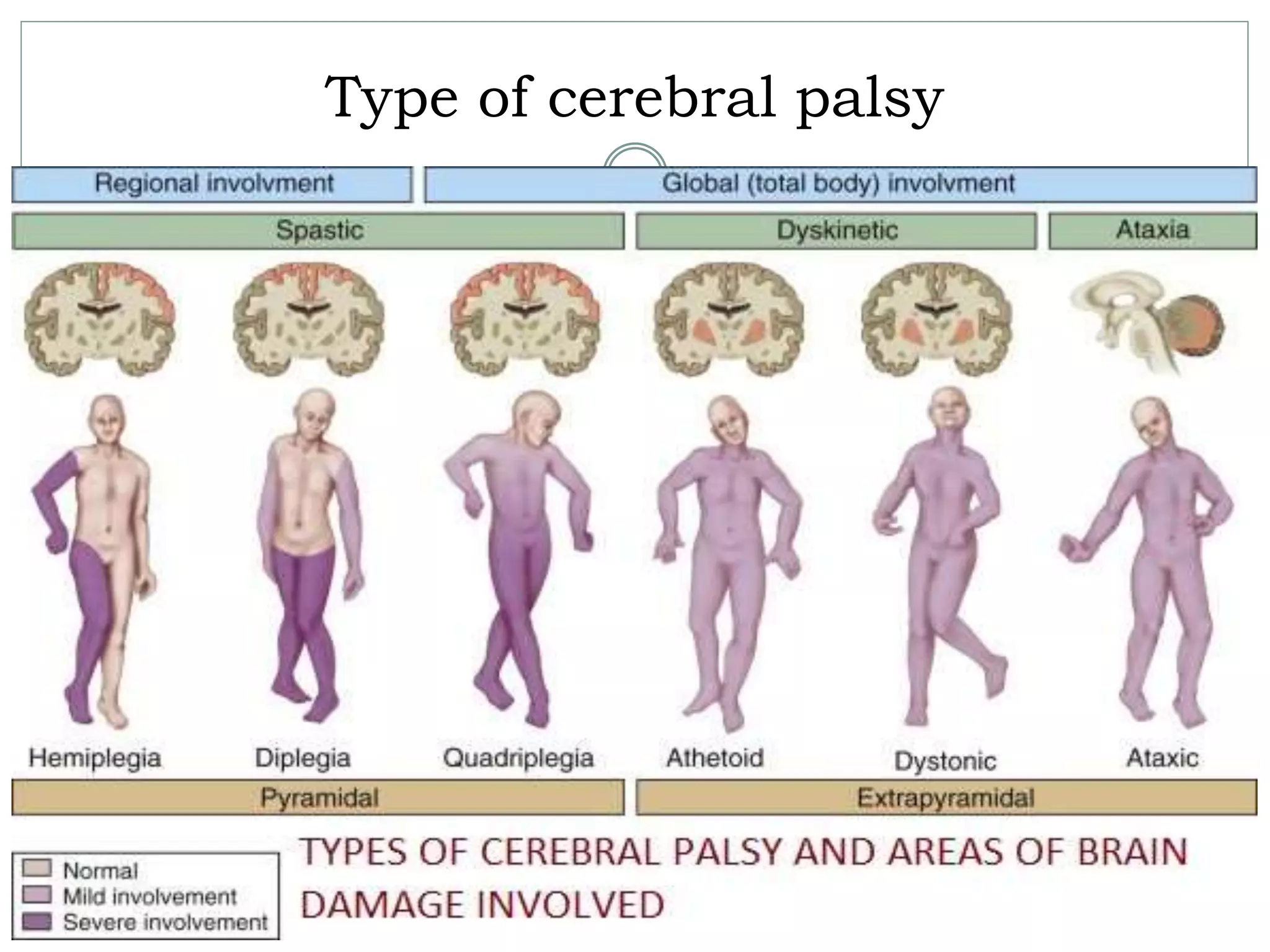 Cerebral Palsy | PPTX
