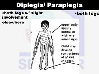 Cerebral palsy classification | PPTX