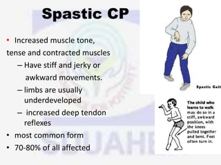 Cerebral palsy classification | PPTX