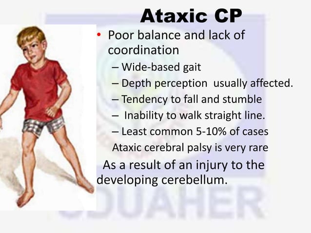 Cerebral palsy classification | PPTX