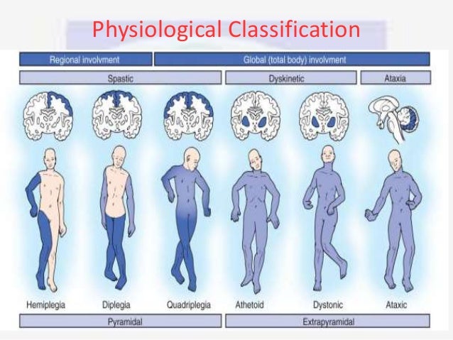 Cerebral palsy classification