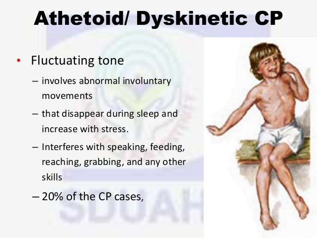 Cerebral palsy classification