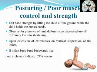 Cerebral palsy | PPTX