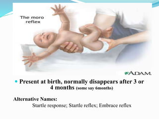 Cerebral palsy | PPTX