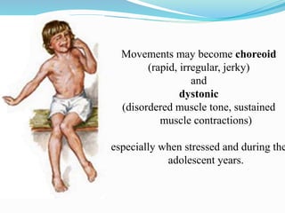 Dystonic Cerebral Palsy